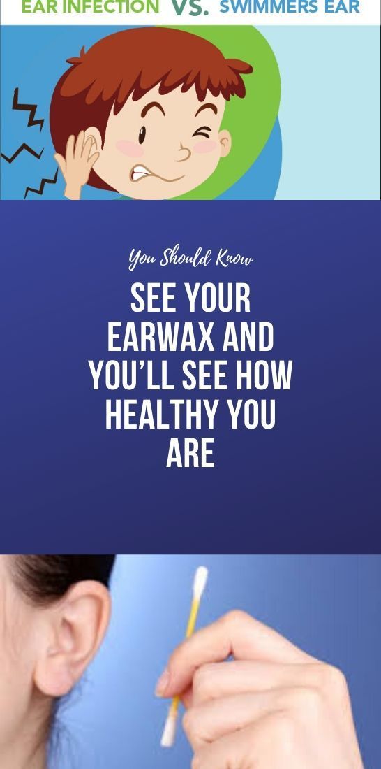 Your Earwax Can Tell How Healthy You Are. What Color Is Yours? - Quoqlee